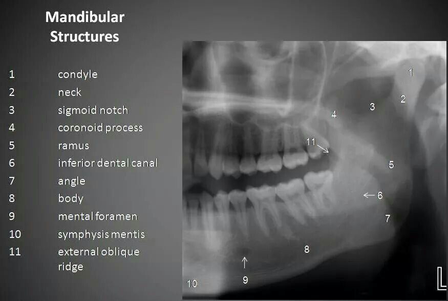Mandibular condyle pain. Understanding Temporomandibular Joint Pain ...